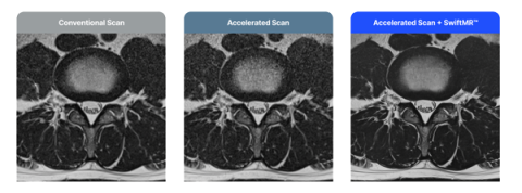 3T Verio MRI - Red River Valley Radiology Associates, PA